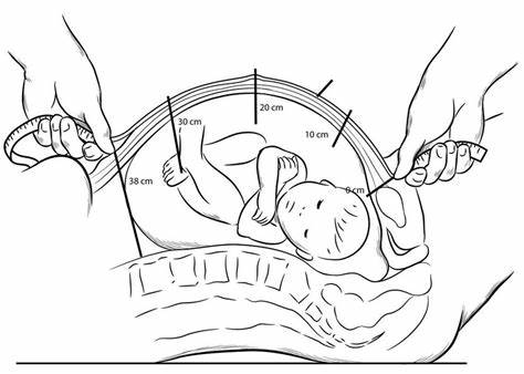 Penting, Ketahui Cara Menghitung Tinggi Fundus Uteri (TFU) - Mamabear